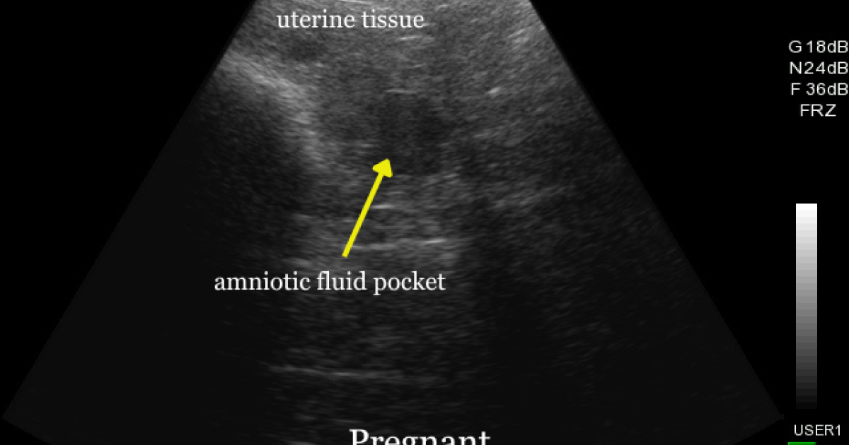 Detecting Pregnancy and Litter Size in Ewes Using Ultrasound
